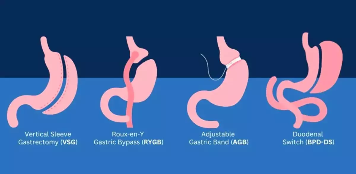 Nathalie Holscher Tampil Ceria Usai Jalani Operasi Bariatrik, Akui ...